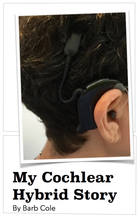 How Does a Cochlear Implant Sound vs Normal Hearing? Barb Cole Shares ...